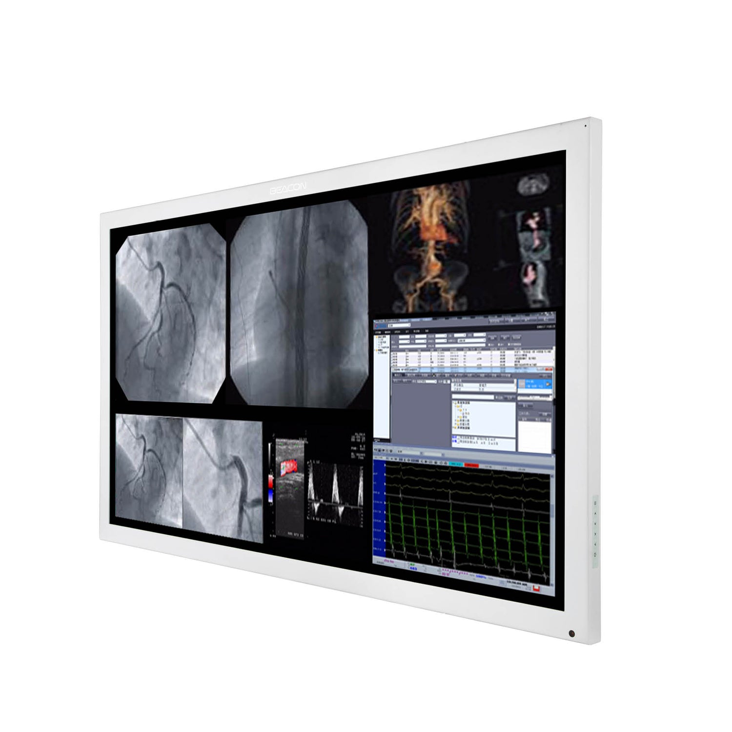 Beacon Endoscopy & Surgical Monitors